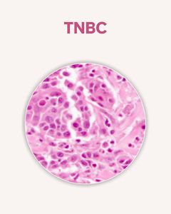 TNBC