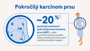 Typy nádorů dle stadia