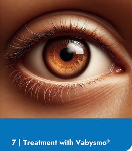 Vabysmo Patient Guide