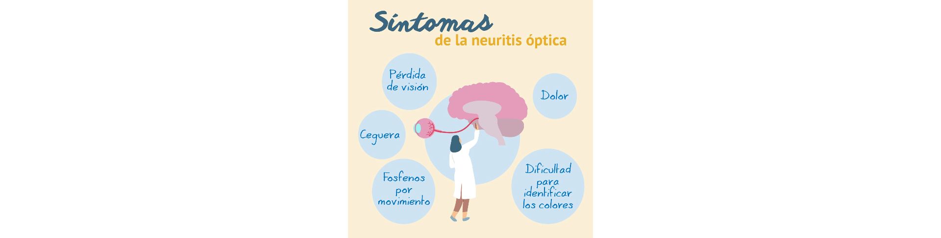 Síntomas de la Neuromielitis óptica | Roche Pacientes