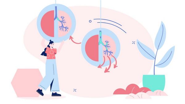 Cáncer de Pulmón Microcítico y No Microcítico | Roche Pacientes