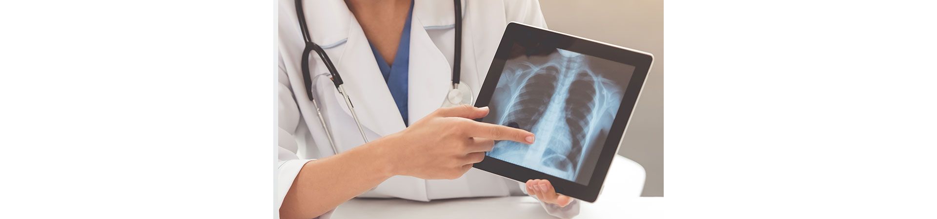 ¿Cómo Funcionan los pulmones? | Roche Pacientes